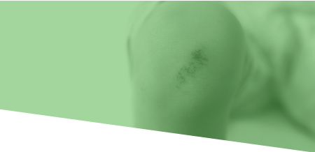 Curso DermaPRO. Patología dermatológica en pediatría